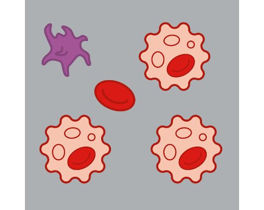 What is AML remission and why is it important?